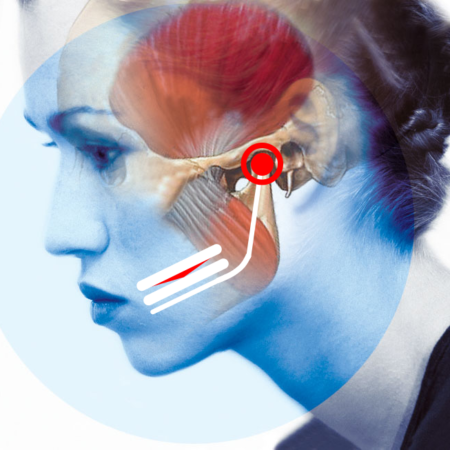 CLEARsplint – Zahntechnik Jonas